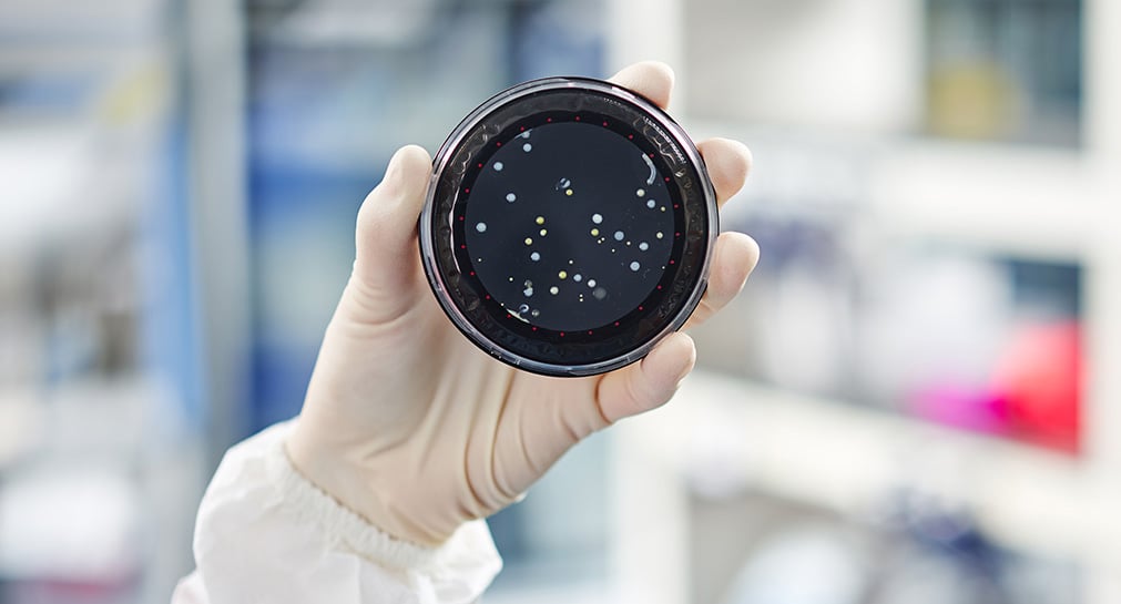 Benefits and Strategies for Automating Growth-Based Microbial Detection